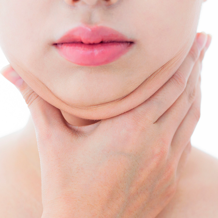 Cómo Eliminar La Papada Sin Liposucción - La Guía de las Vitaminas