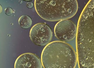 Colesterol VLDL: Qué Es, Niveles Normales, Funciones Y Laboratorio - La ...